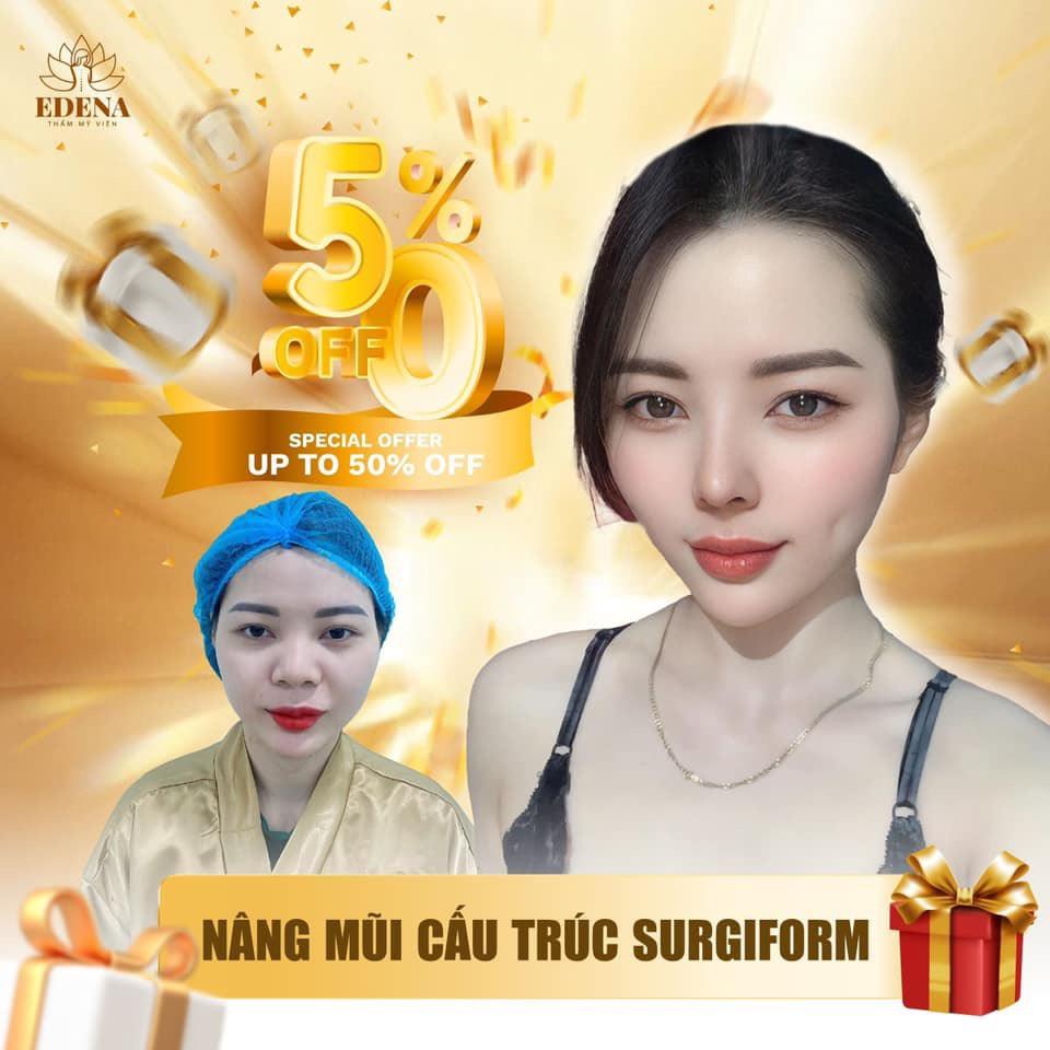 Địa chỉ nâng mũi cấu trúc sụn surgiform uy tín tại Thành phố Hồ Chí Minh